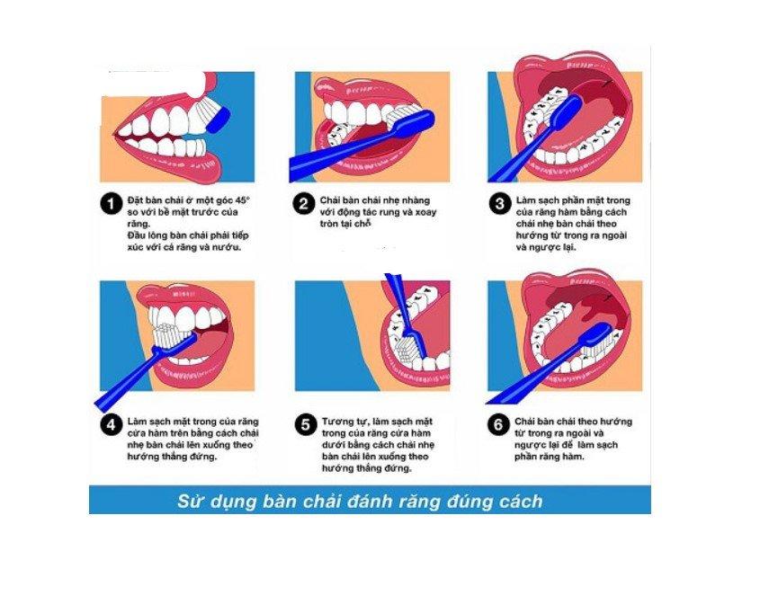 Làm thế nào để khắc phục tình trạng răng xỉn màu ngay tại nhà ...